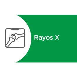 Rayos x 6 proyecciones | Laboratorios Chopo