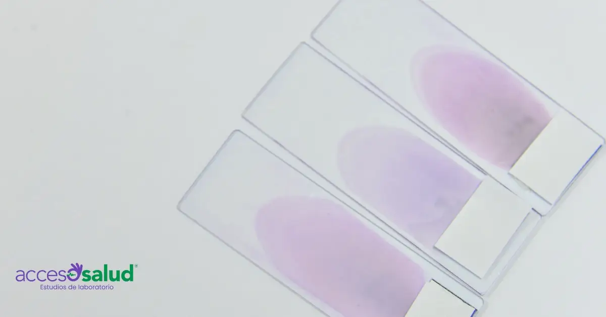 Biometría hemática | ¿En qué consiste?